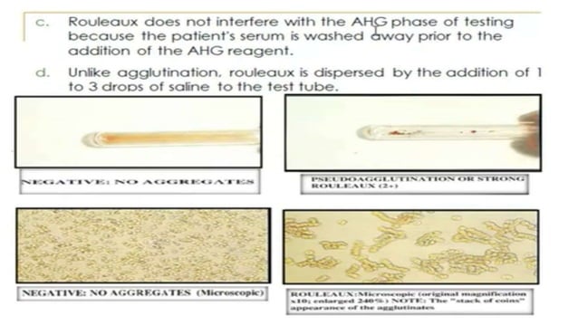 Case presentation on Antibody screening- how to solve 3 cell and 11 ...