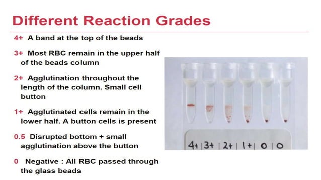 Case presentation on Antibody screening- how to solve 3 cell and 11 ...