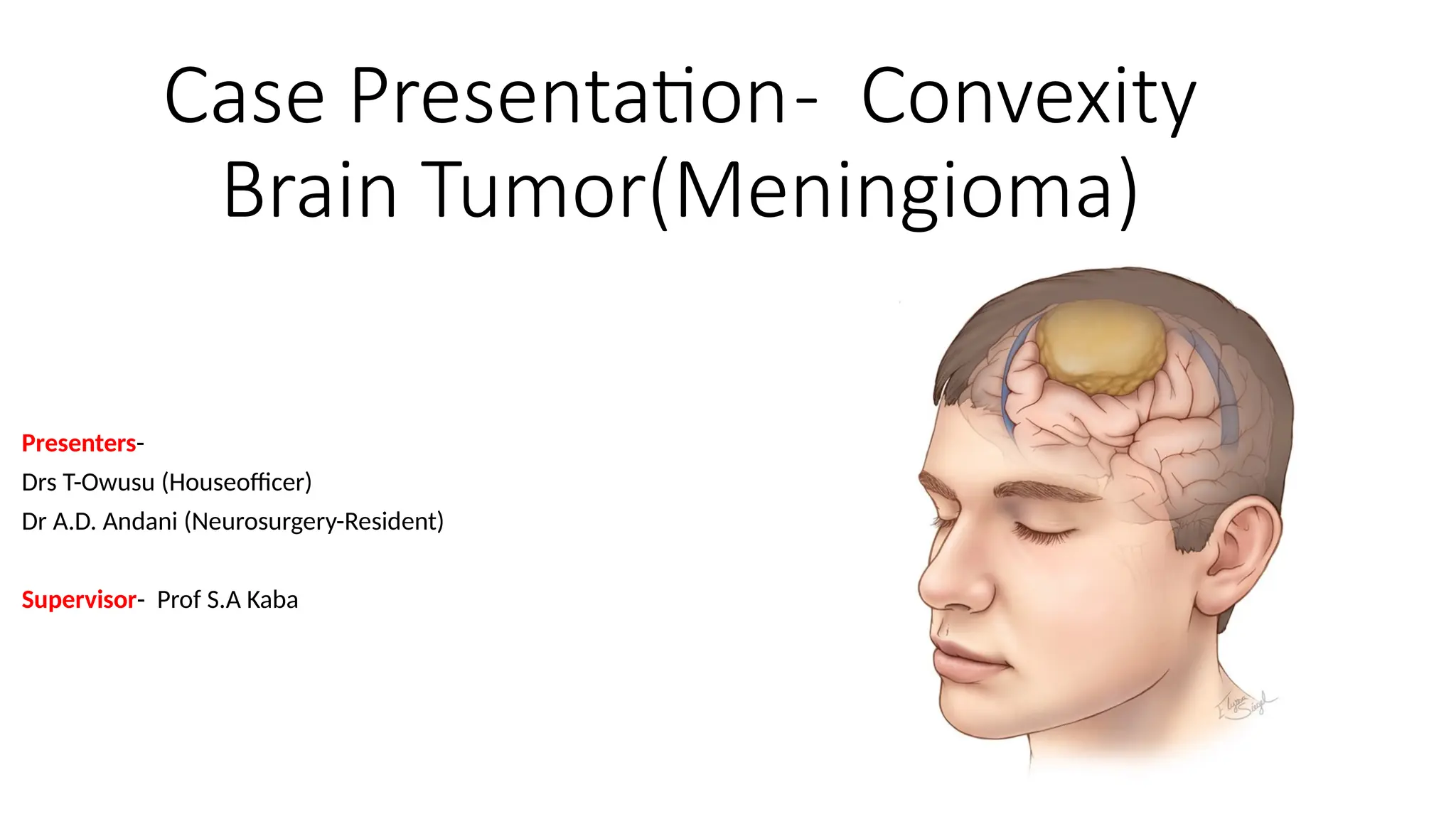 Case Presentation - Convexity Brain Tumor(Meningioma).pptx