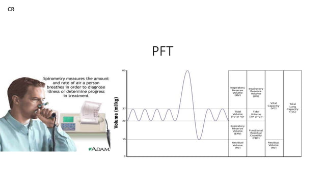 CASE PRESENTATION-COPD.ppt