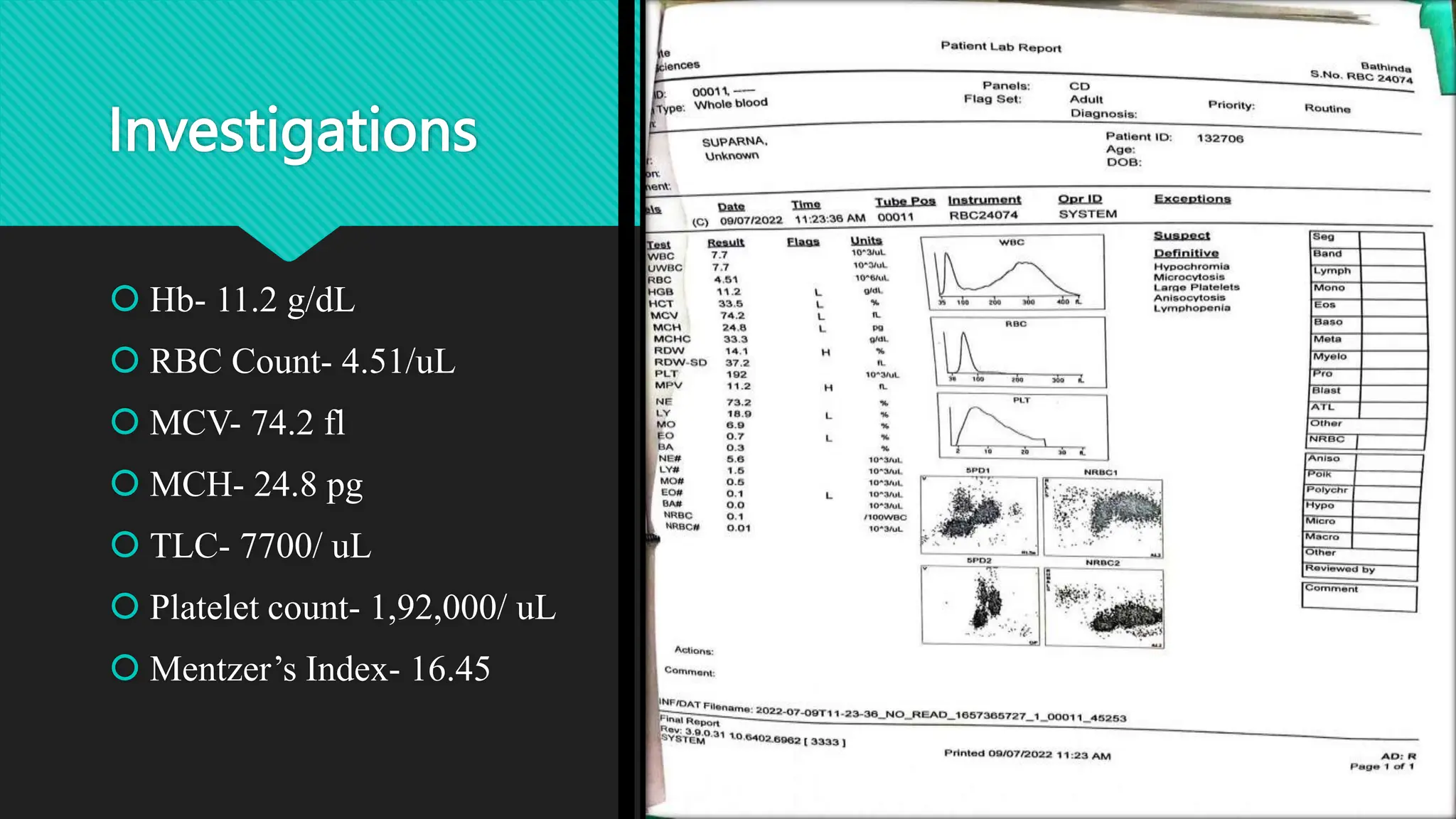 Case presentation onHeterozygous variant of Hemoglobin E | PPTX