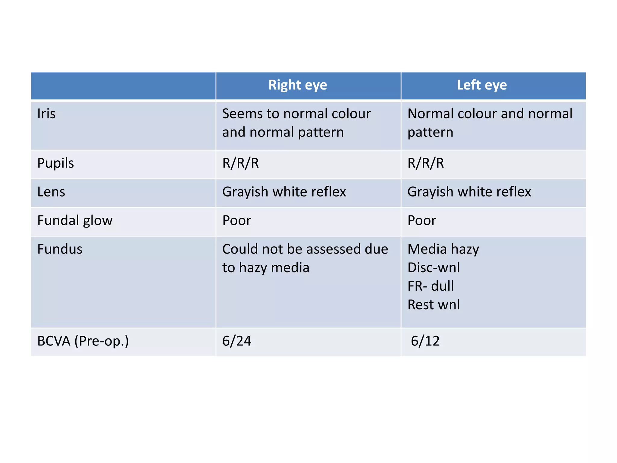 Ocular surface neoplasia (OSSN)- Case report | PPTX