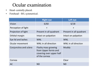 Ocular surface neoplasia (OSSN)- Case report | PPTX