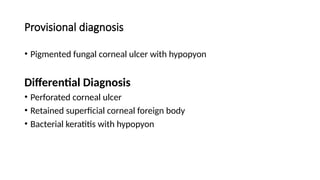Case Presentation - Pigmented Fungal Corneal Ulcer | PPTX
