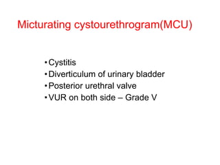 Posterior Urethral Valve - Case presentation | PPT