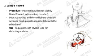 Case Presentation - Solitary Thyroid Nodule.pdf