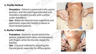 Case Presentation - Solitary Thyroid Nodule.pdf