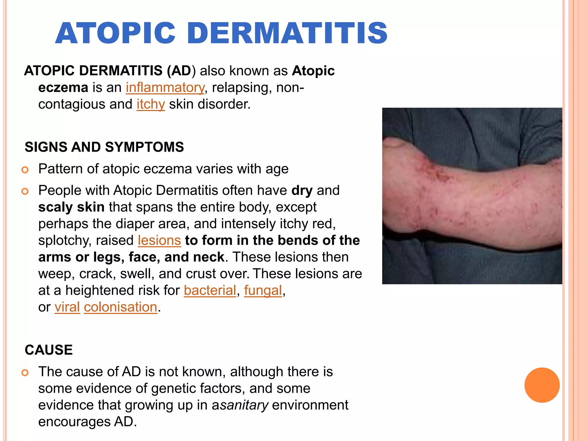 Stasis Dermatitis - Case Presentation | PPTX