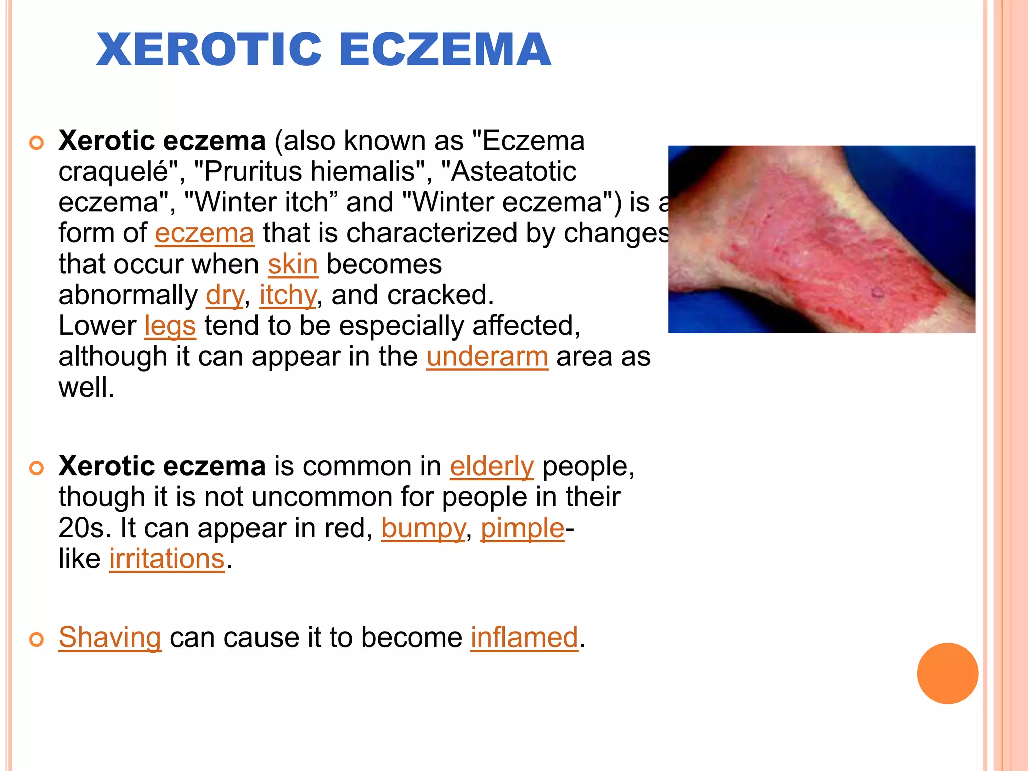 Stasis Dermatitis - Case Presentation | PPTX