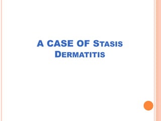 Stasis Dermatitis - Case Presentation | PPTX