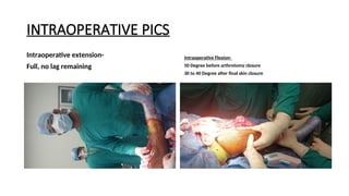 CASE PRESENTATION- hOW TO PERFORM total knee replacement surgery in ...