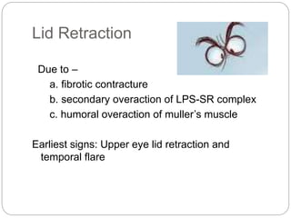 Thyroid Eye Disease - Case and Discussion | PPTX