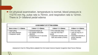 case presentation: generalized edema | PPTX