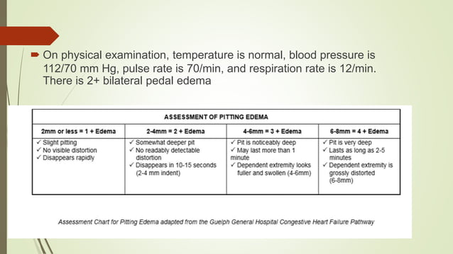 case presentation: generalized edema | PPTX