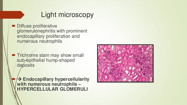 Generalized Edema Generalized And Localized Edema: A Clinical