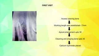 CASE Presentation2 - Copy.pptx