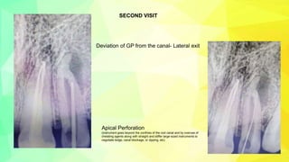 CASE Presentation2 - Copy.pptx