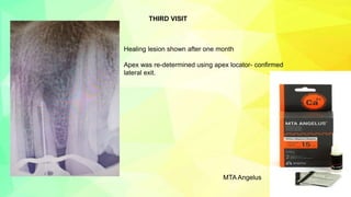 CASE Presentation2 - Copy.pptx