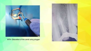 CASE Presentation2 - Copy.pptx