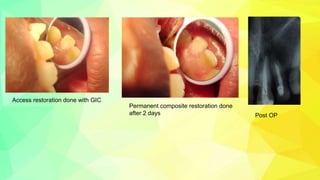 CASE Presentation2 - Copy.pptx