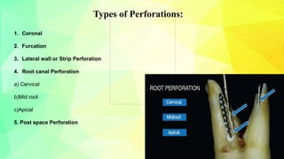 CASE Presentation2 - Copy.pptx