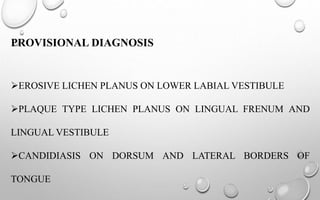 case presentation 3 : LICHEN PLANUS.pptx