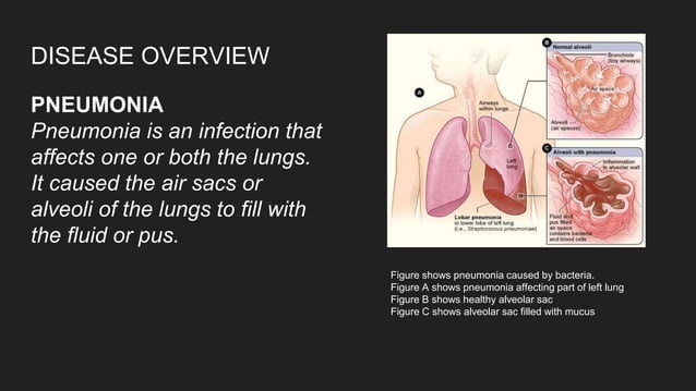 An Approach to a Case of Severe Pneumonia with Iron Deficiency Anemia ...