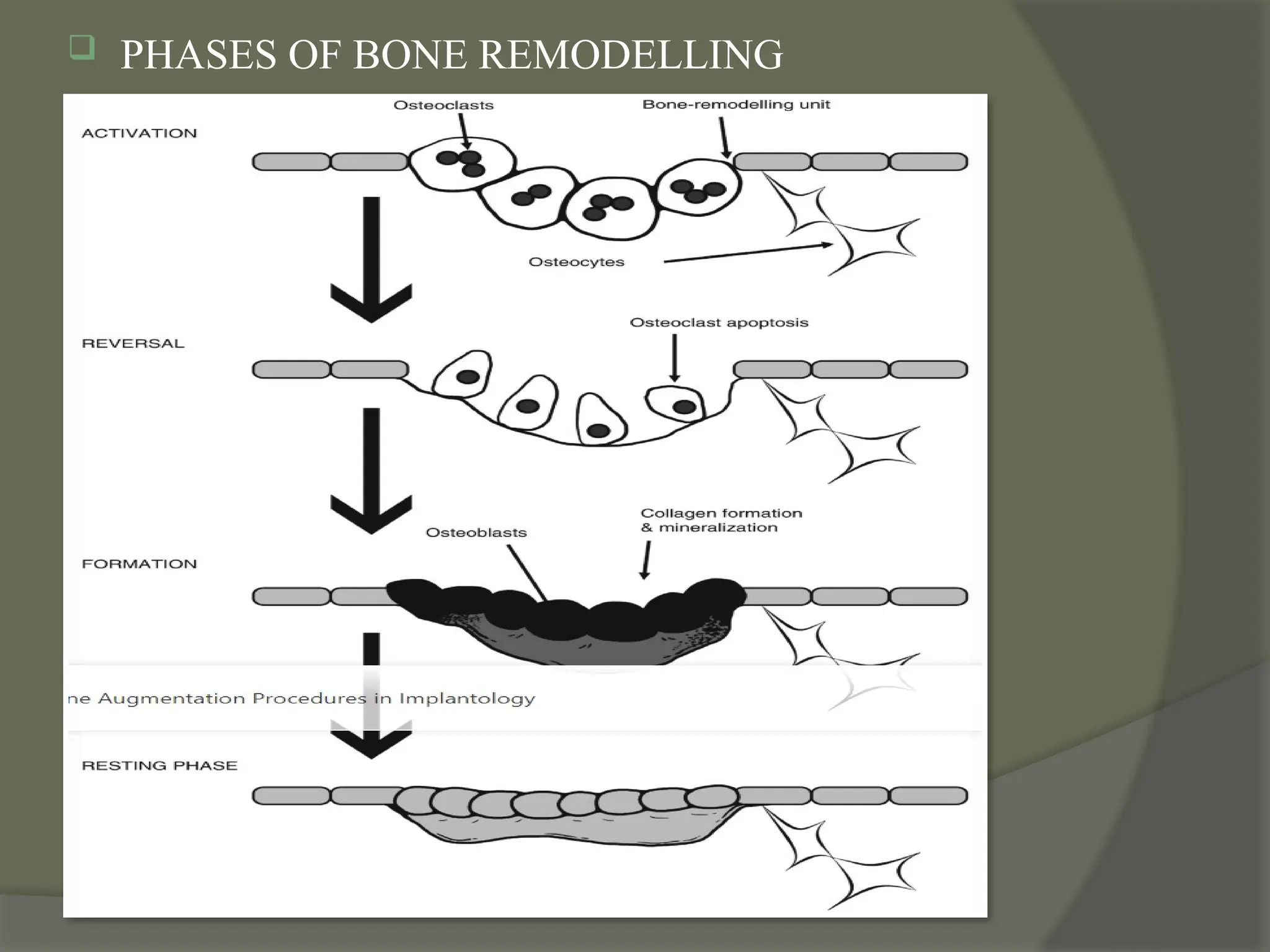 CASE PRESENTATION 4 Symphyseal Grafting.pptx