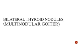 Case presentation on multinodular goiter | PPTX