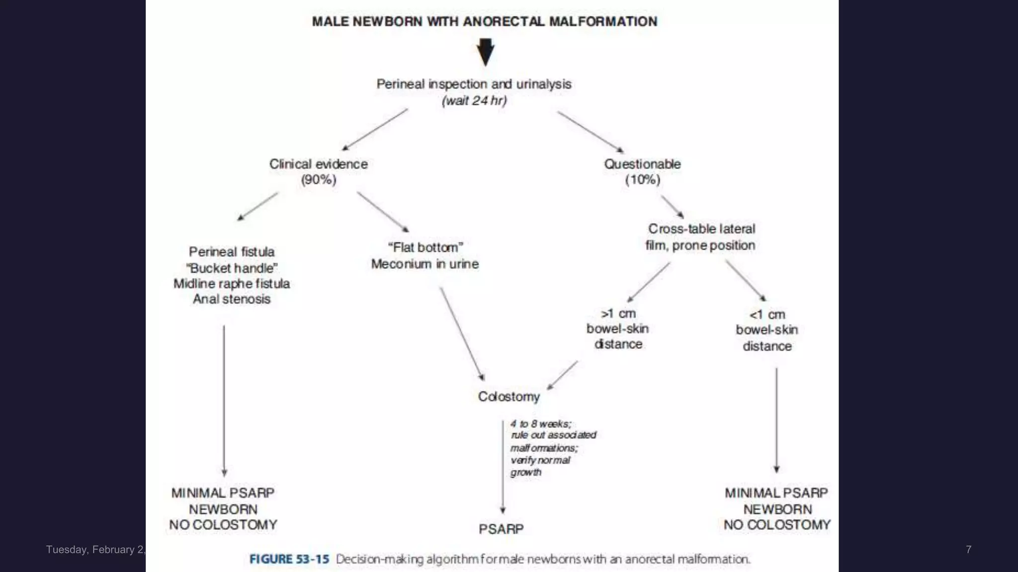 CASE Presentation Anorectal Malformation.pptx
