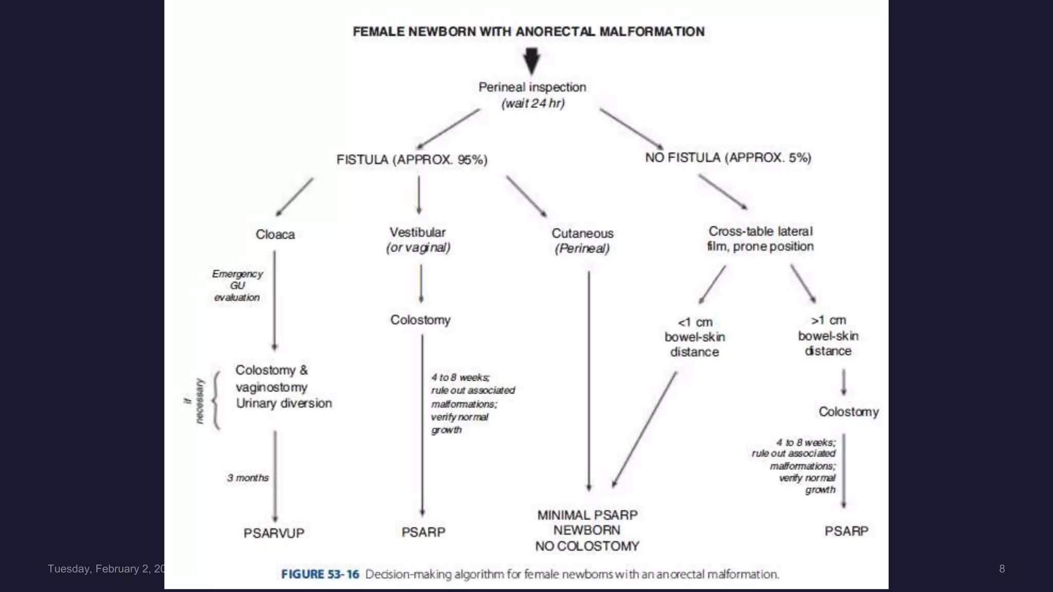 CASE Presentation Anorectal Malformation.pptx