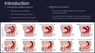 CASE Presentation Anorectal Malformation.pptx
