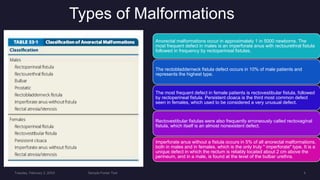 CASE Presentation Anorectal Malformation.pptx