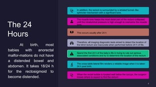 CASE Presentation Anorectal Malformation.pptx