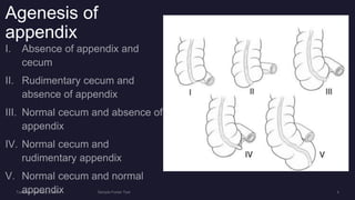 CASE Report General Surgery Residency Presentation Appendicitis.pptx ...
