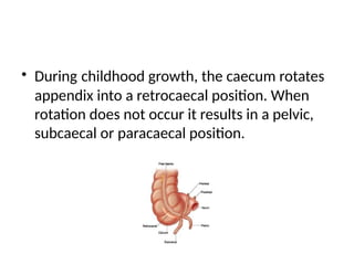 APPENDECTOMY INDICATIONS AND PROCEDURE............... | PPT