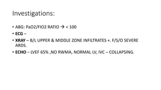 Case presentation ARDS.pptx