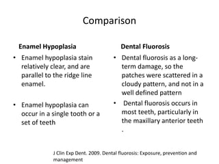 Case presentation Fluorosis | PPTX