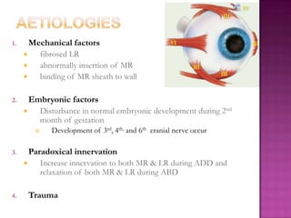 Case presentation 2 : Duane's Syndrome | PPTX