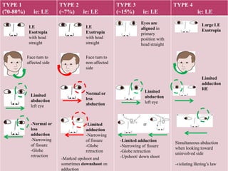 Case presentation 2 : Duane's Syndrome | PPTX
