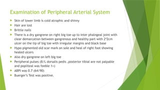 CASE PRESENTATION Peripheral vascular disease | PPTX
