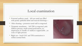 Cholesteatoma Case Presentation .pptx