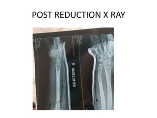 CASE PRESENTATION COLLES.pptx