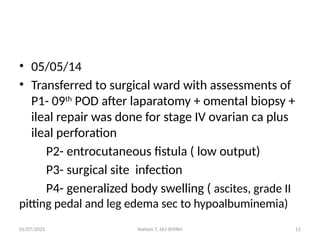 Case presentation Colovesical fistula.pptx