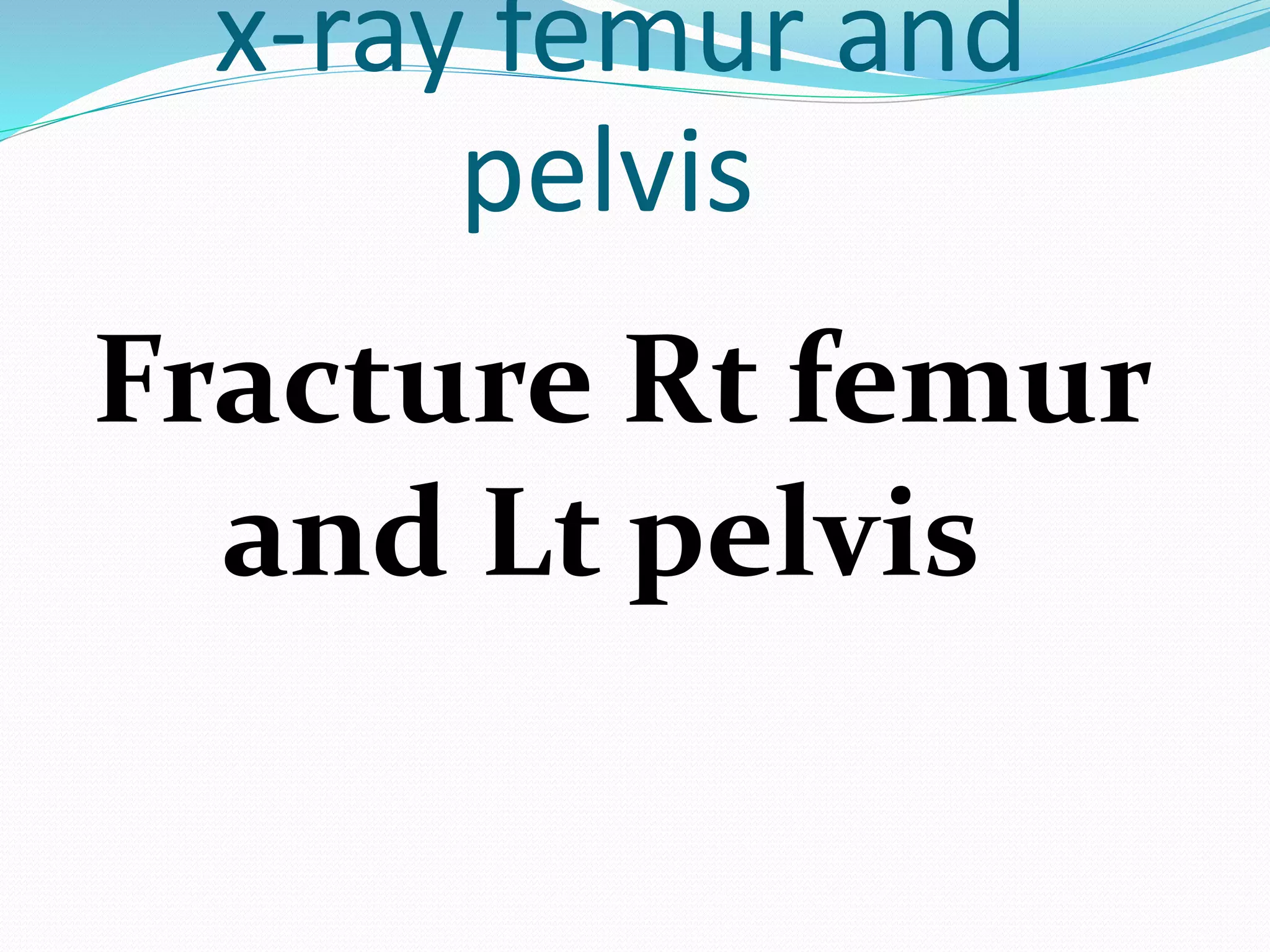 Case presentation dr isla | PPT