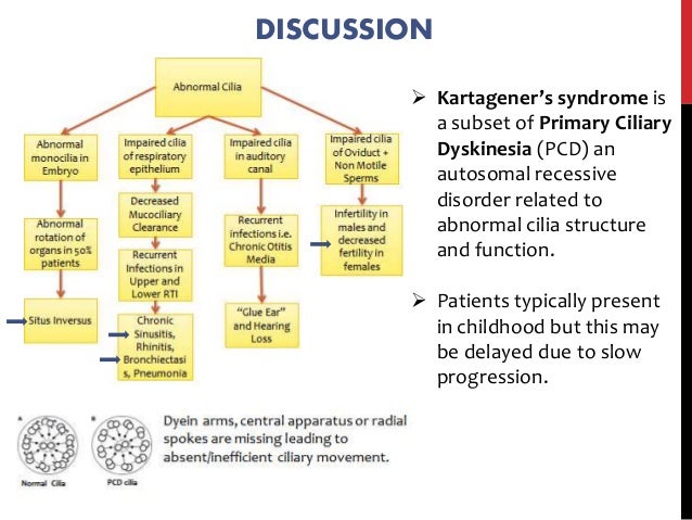 Kartagener syndrome – Medical Student Revision Blog