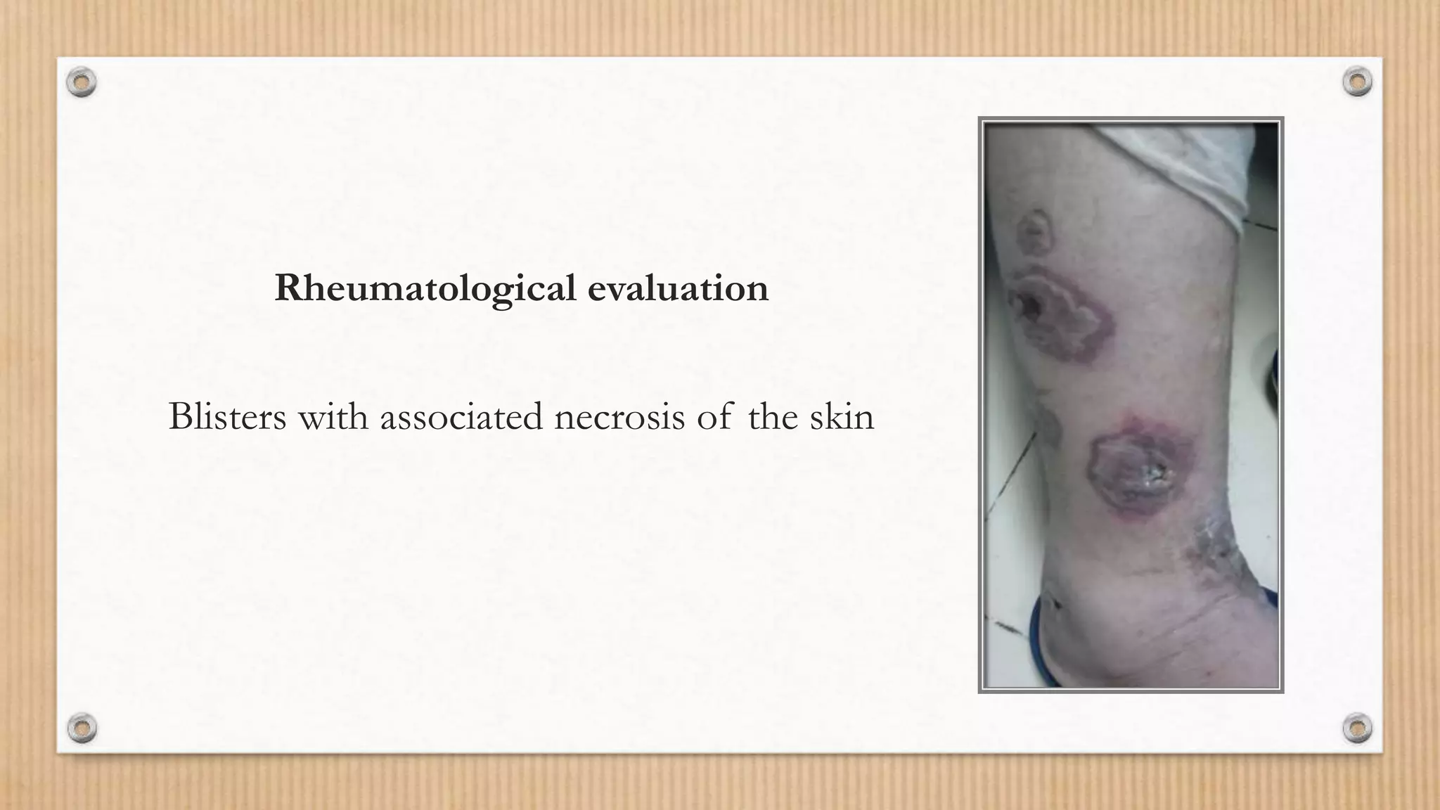 Rheumatological Case Study | PPTX