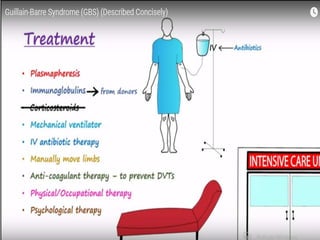 GUILLAIN BARRE SYNDROME | PPTX