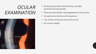 Case presentation - Corneal ulcers and dystrophies | PPTX