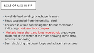 CASE PRESENTATION ON FETUS IN FETO GSC GUNTUR.pptx